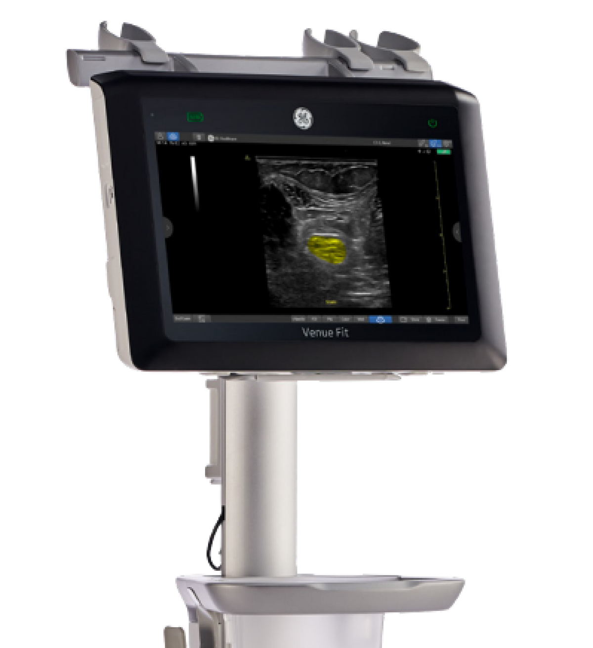 GE Venue Fit™ R5 Ultrasound System