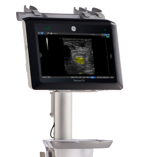 GE Venue Fit™ R5 Ultrasound System